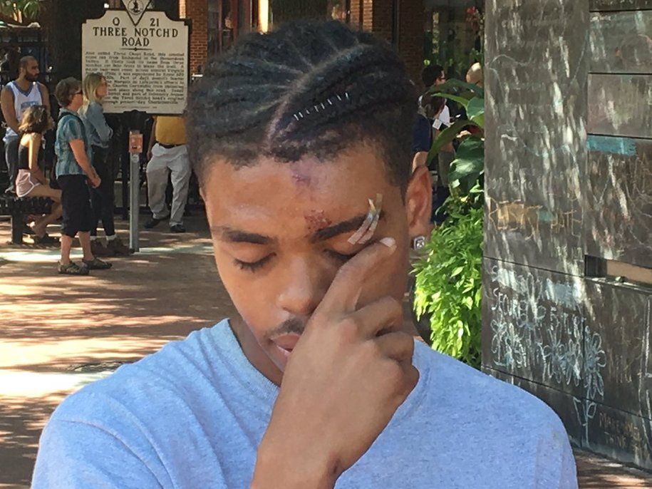 Why is DeAndre Harris, a Victim of Violent Racism, Under Arrest ...